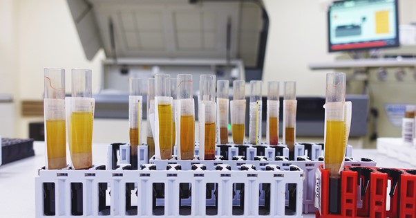 Future of Drug Discovery: Exploring the Advantages of Cell-Based Assays