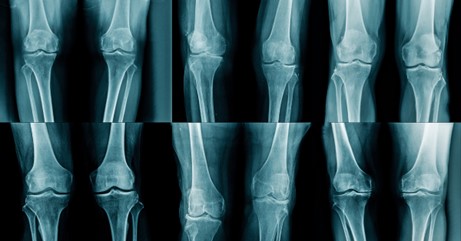 List of Orthopedic Imaging Modalities That Are Enhancing Orthopedic ...